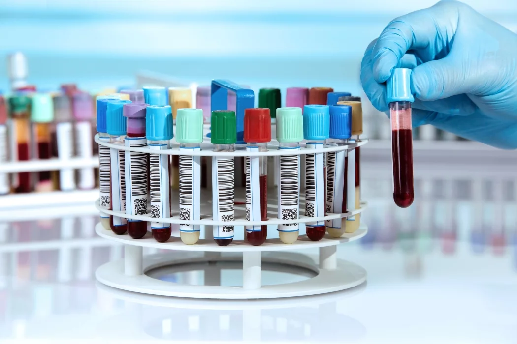 Medical label solutions for enhanced accuracy and compliance - QLM Group